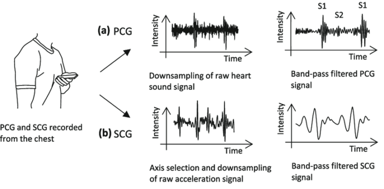 Construction-of-the-phonocardiogram-PCG-and-seismocardiogram-SCG-signal ...