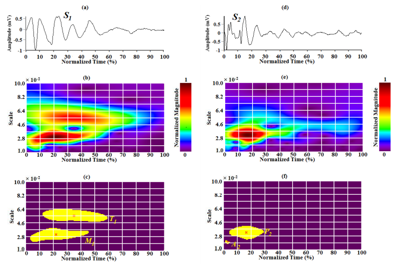 Signal Processing And Extensive Characterization Method Of Heart Sounds Based On Wavelet