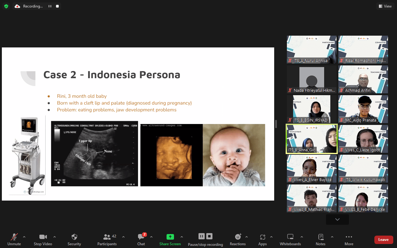 [17 Mei 2024] ITS-Vives COIL 2024 3rd Meeting Medical Devices for ...